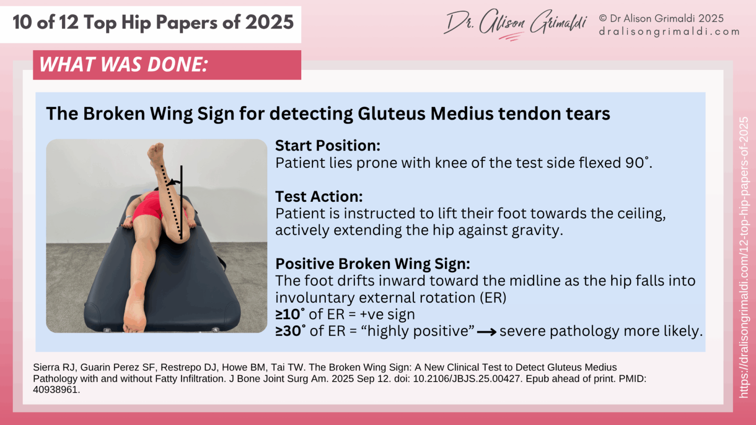 The Broken Wing Sign: A Clinical Test for Gluteus Medius Tendon ...
