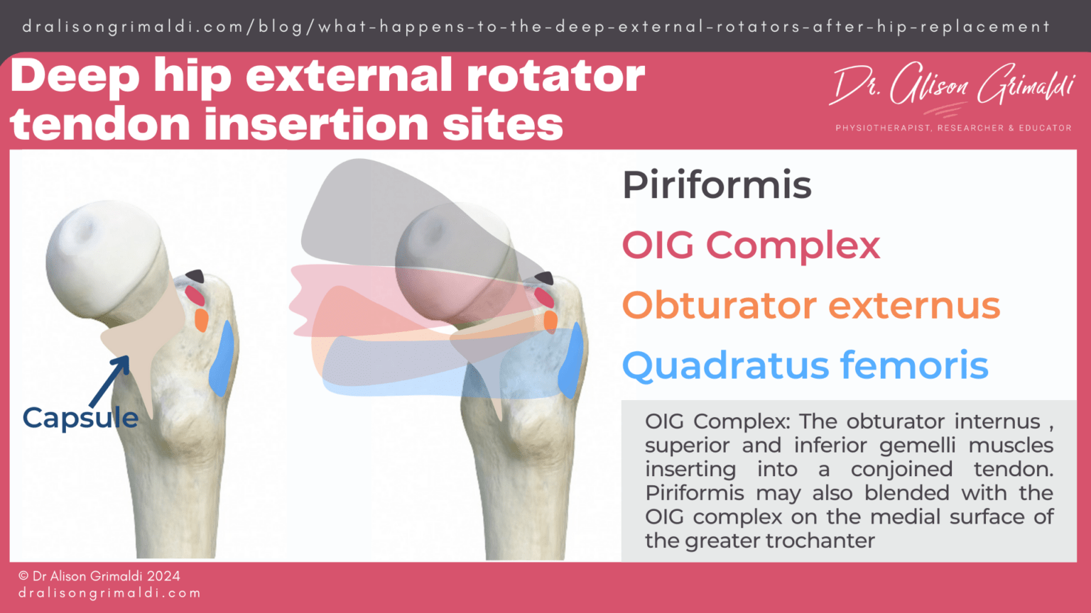 What happens to the deep external rotators after hip replacement | Find ...