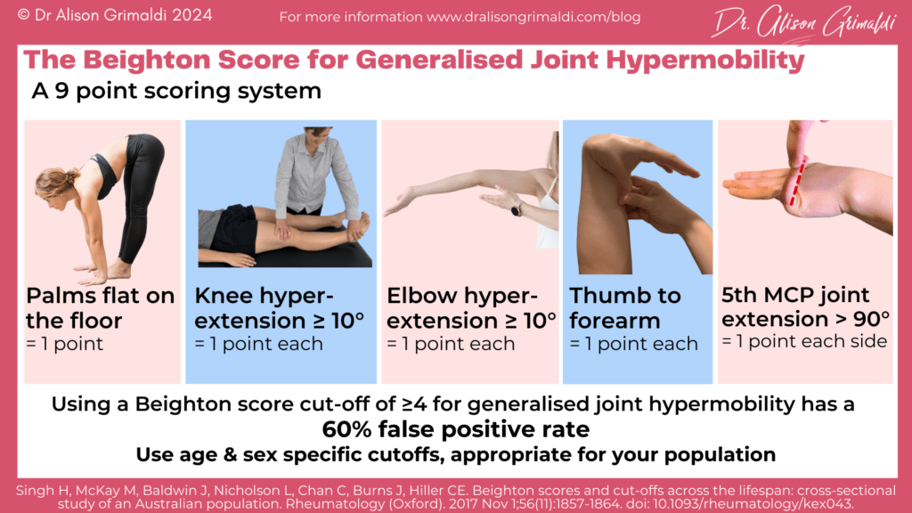 Identifying joint hypermobility syndromes and measuring the impact ...