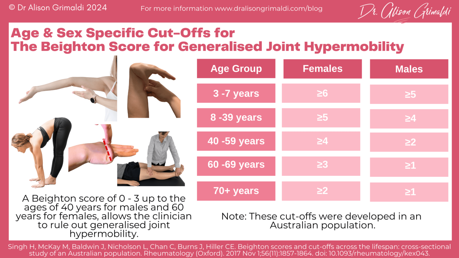 Identifying joint hypermobility syndromes and measuring the impact ...